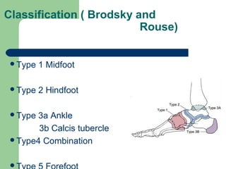 Neuropathic (Charcots) joints | PPT