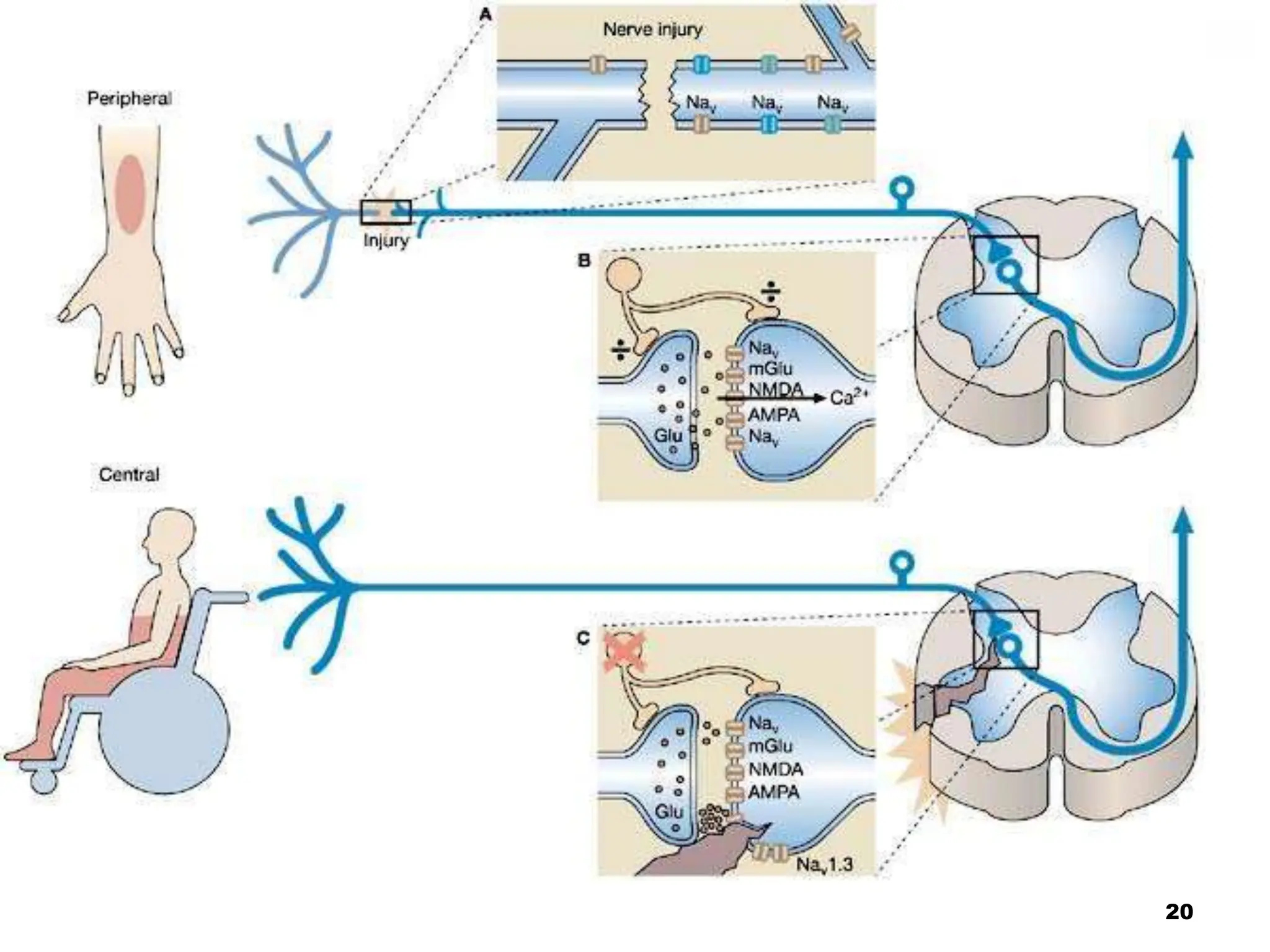 neuropathic pain syndrome.ppt