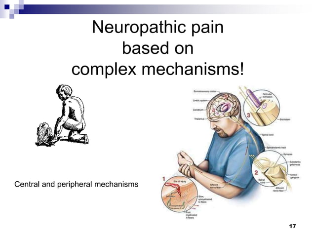 neuropathic pain syndrome.ppt