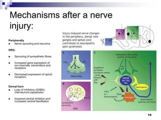 neuropathic pain syndrome.ppt