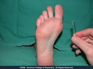 Neuropathic ulcers and diabetic foot ulcer | PPTX
