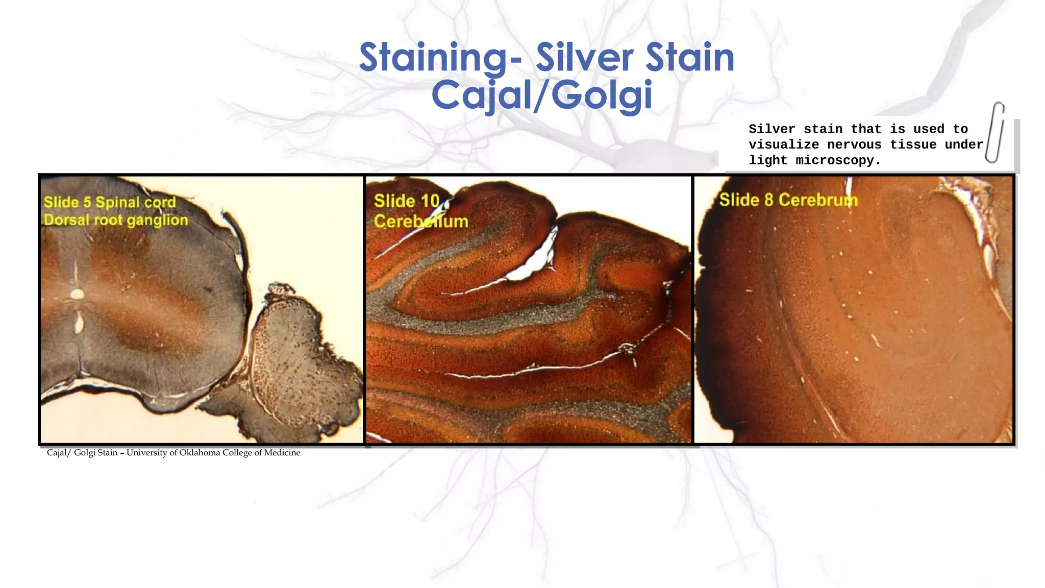 Introduction to Neuropathology | PPT