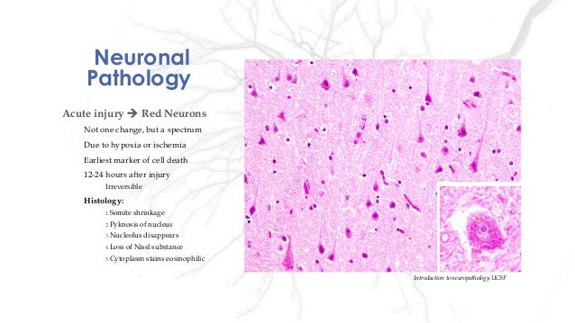 Introduction to Neuropathology