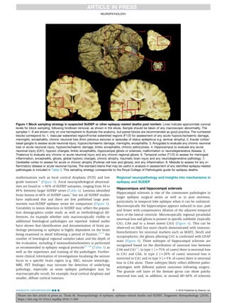 Neuropathology of epilepsy epilepsy related deaths and sudep | PDF
