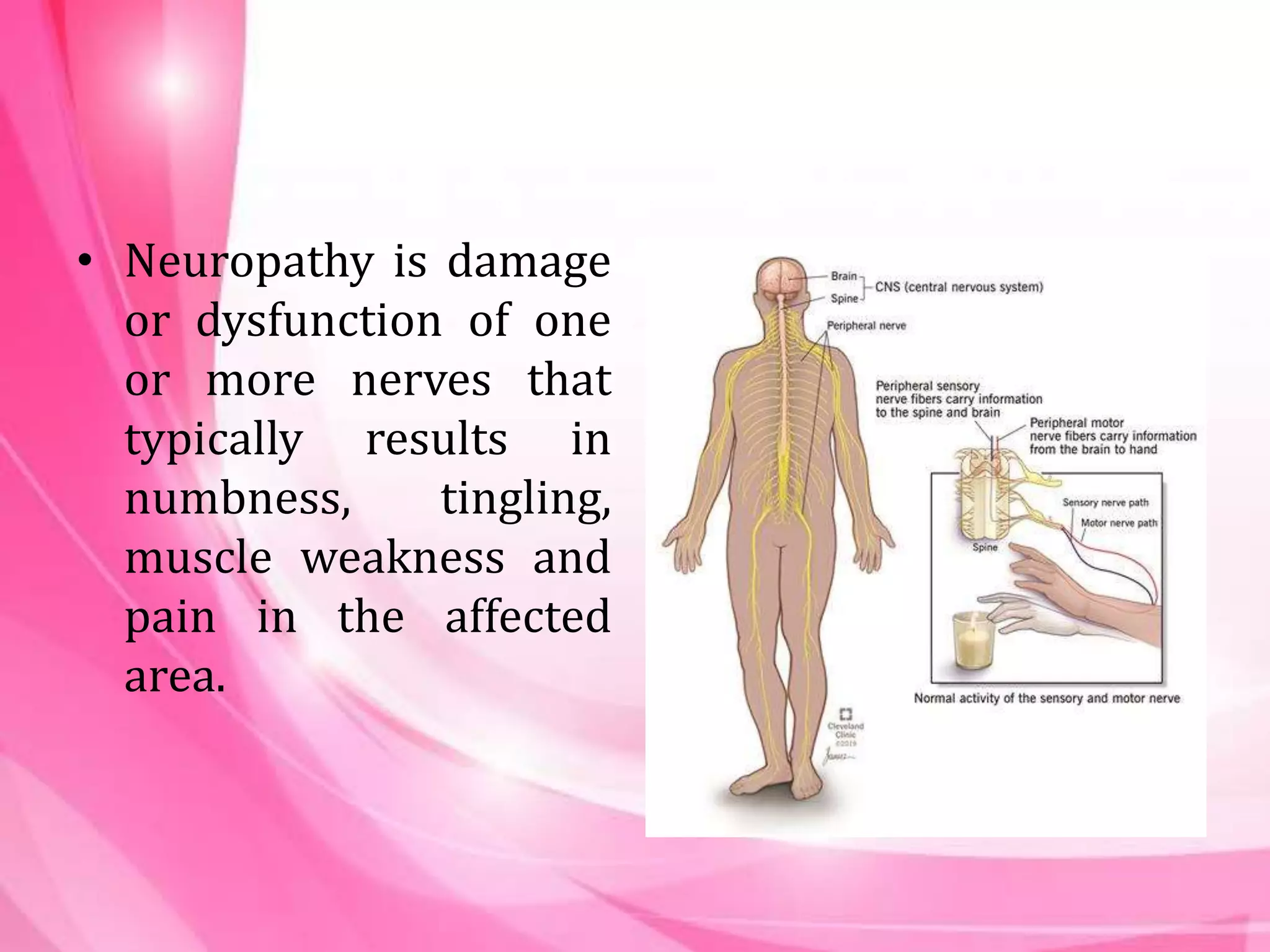Neuropathy | PPTX