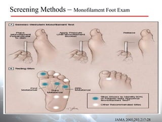 Neuropathy+%26+Diabetic | PPT