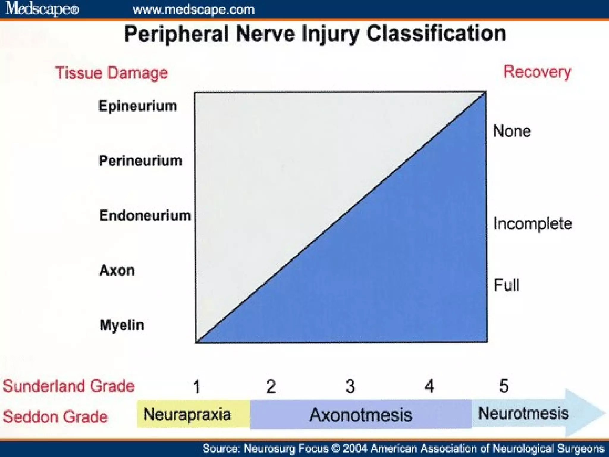 Neuropathy and its classification | PPT