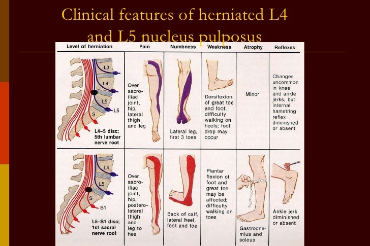 Neuropathy complete2