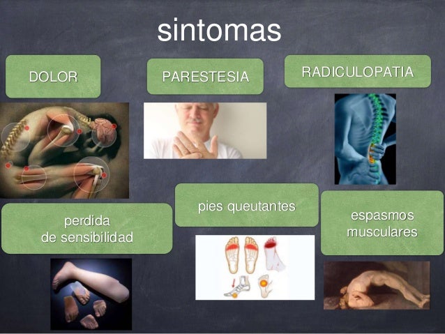 ¿Qué Es La Neuropatía? – Neuropatía: Síntomas, causas y cómo tratar la ...