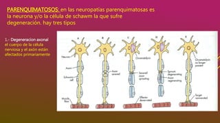 Neuropatias perifericas | PPTX