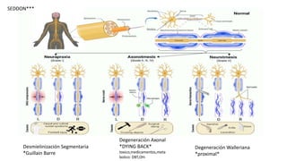 Neuropatias Perifericas.pptx