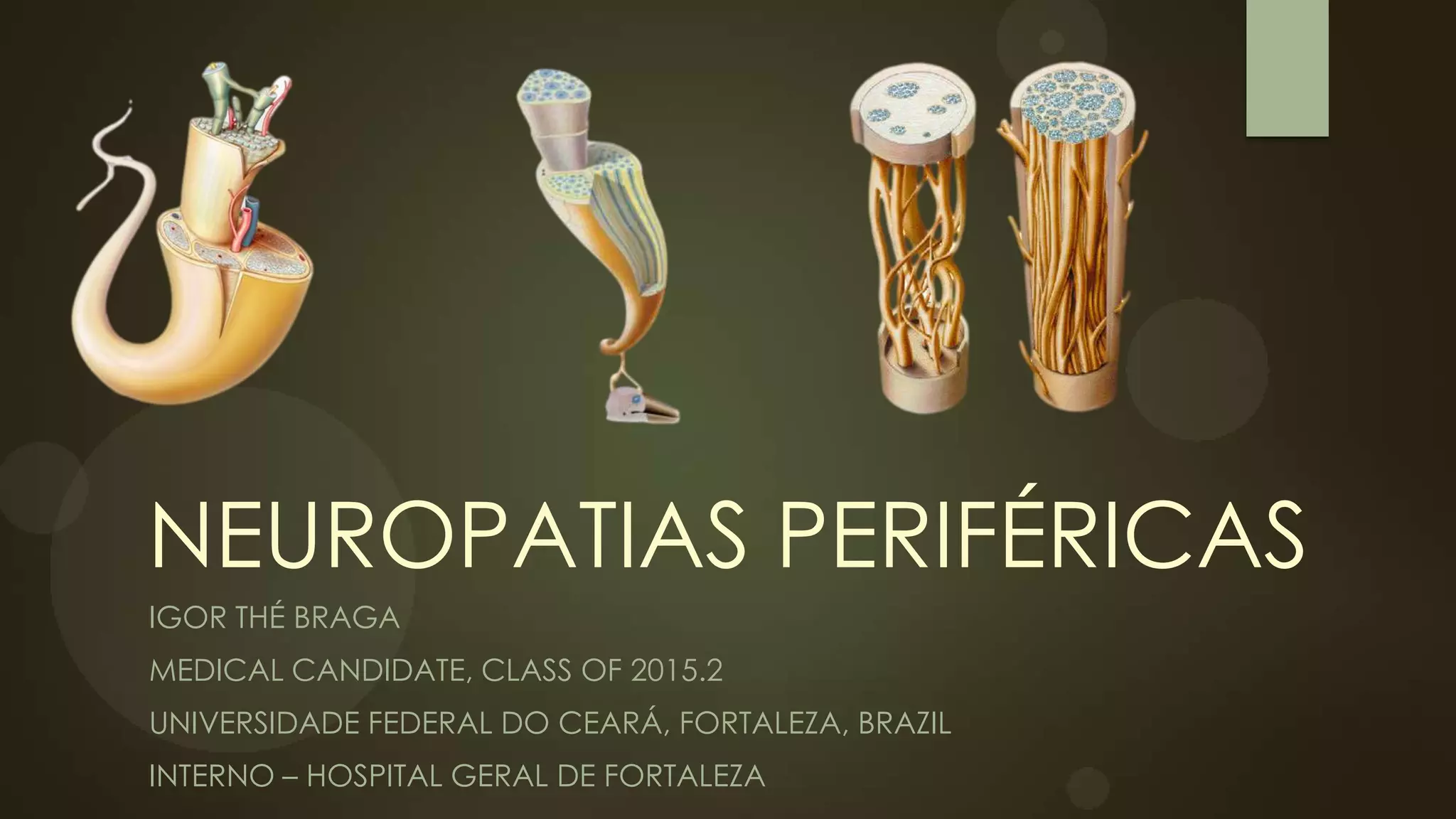 Neuropatias periféricas | PPTX | Brain and Nervous System Disorders ...