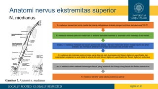 NEUROPATI KOMPRESIF PADA EKSTREMITAS SUPERIOR.pptx