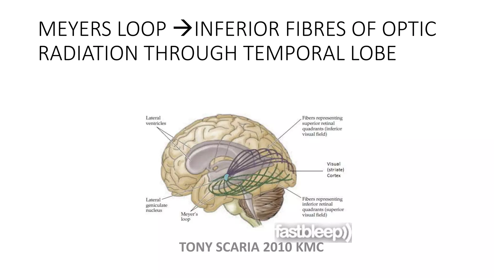 Neurophthalmology REVISION NOTES OPHTHALMOLOGY | PDF
