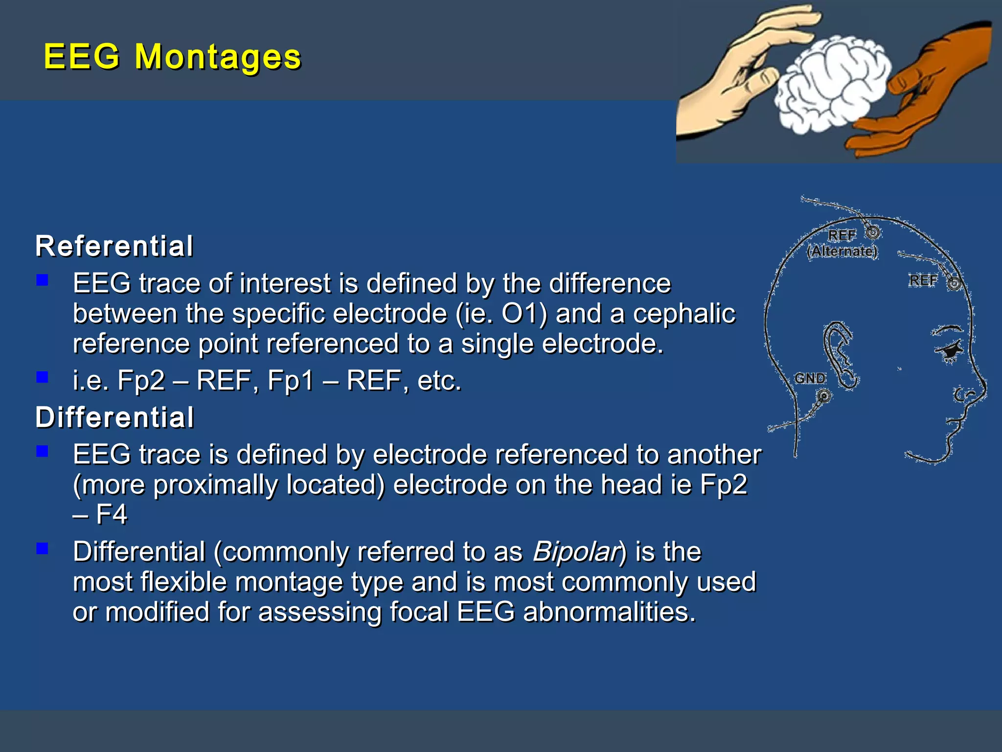 Neuro physiology of seizures & eeg, pedaitric neurologist, dr amit ...