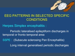 Neuro physiology of seizures & eeg, pedaitric neurologist, dr amit ...