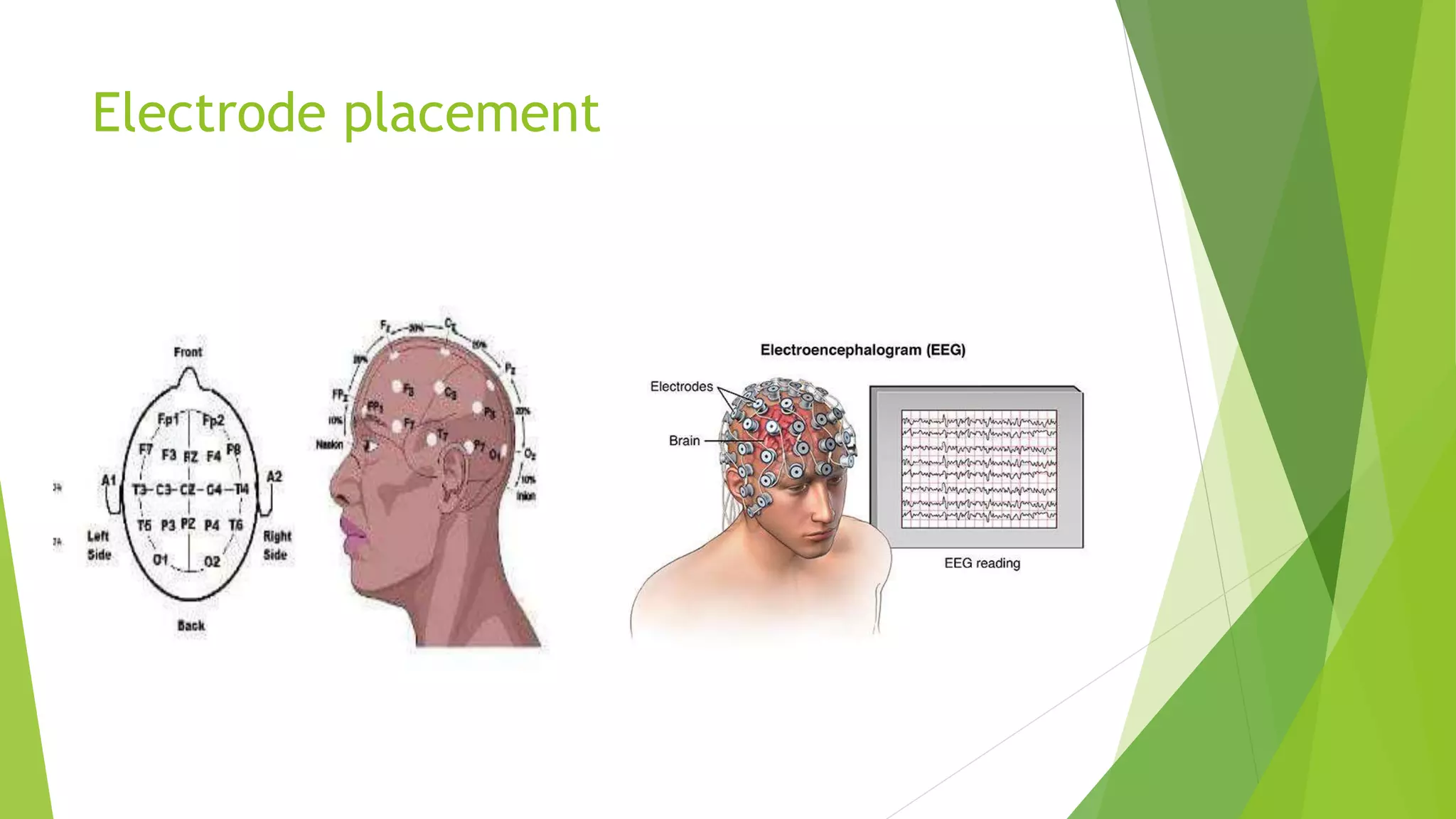 NEUROPHYSIOLOGY technique.pptx