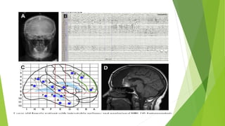 NEUROPHYSIOLOGY technique.pptx