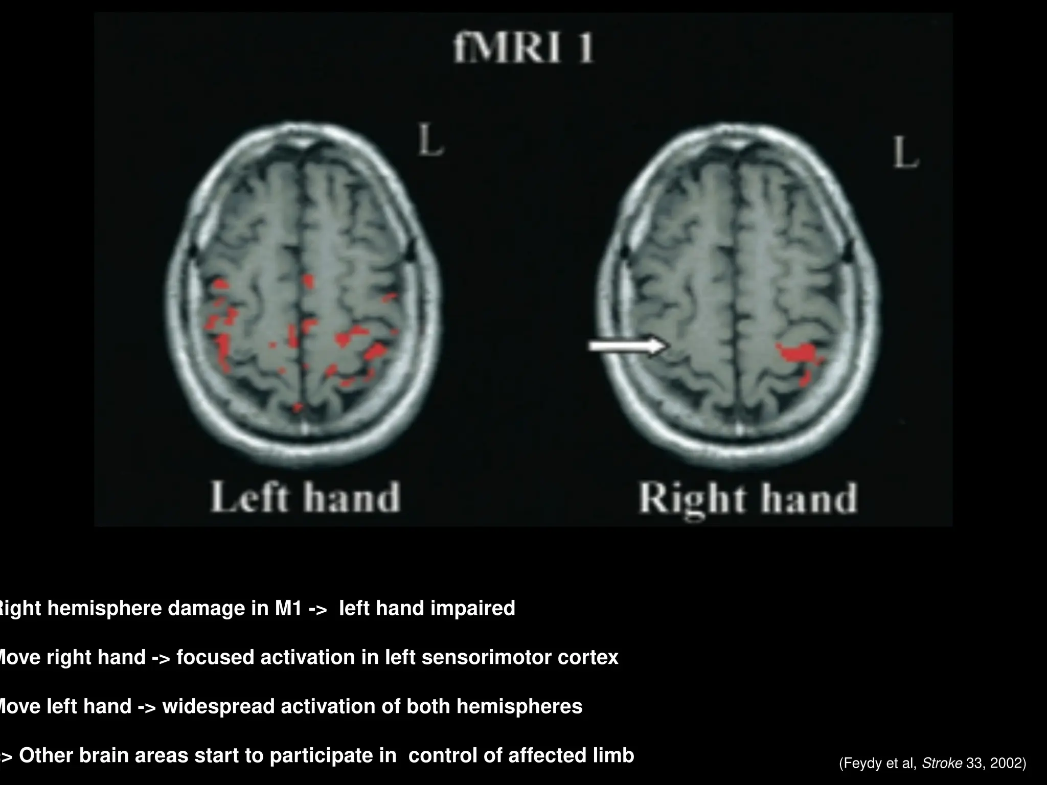 Neuroplasticity-History-Concepts-and-Mechanisms.pptx