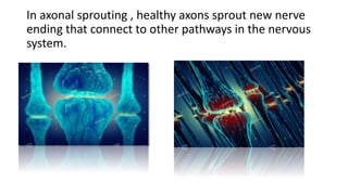 Neuroplasticity | PPT