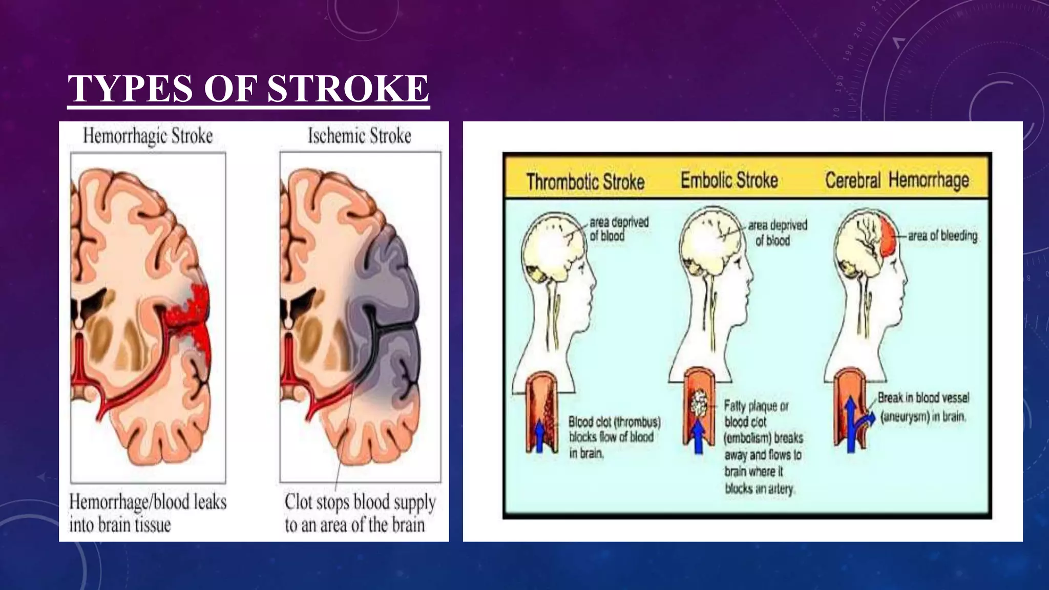 Neuroprotection against cerebral ischemia | PPT