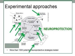 Neuroprotection for stroke | PPTX
