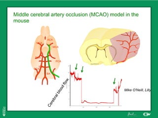 Neuroprotection in neurology | PDF