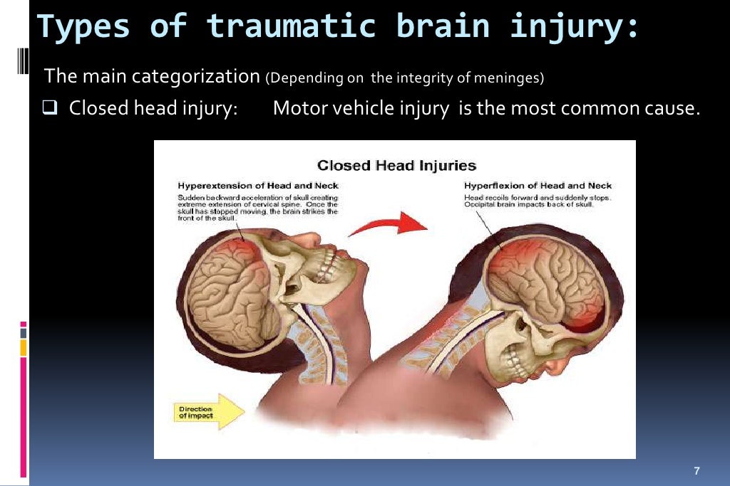neuropsychiatric-manifestations-of-head-injury