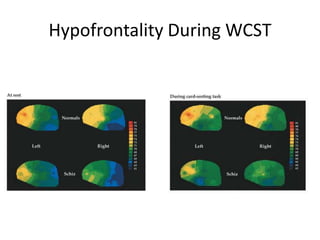 Pathophysiology: Introduction to Neuropsychiatry | PPTX