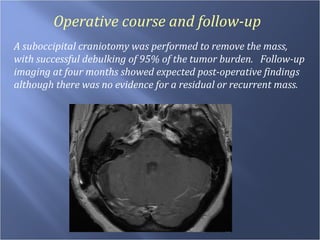 Harbor UCLA Neuro-Radiology Case #9 | PPT