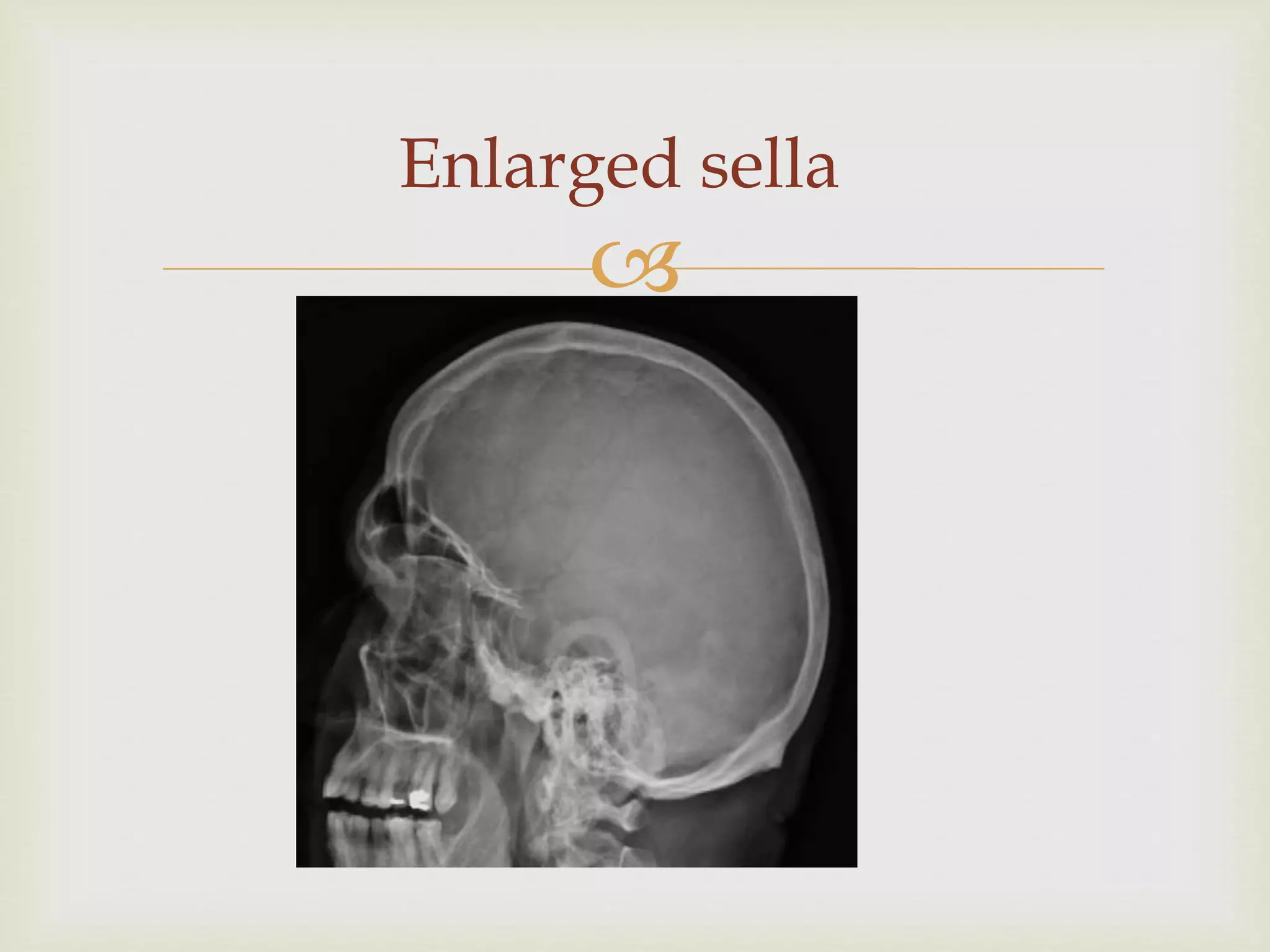 Neuro radiology neuroimaging | PPTX