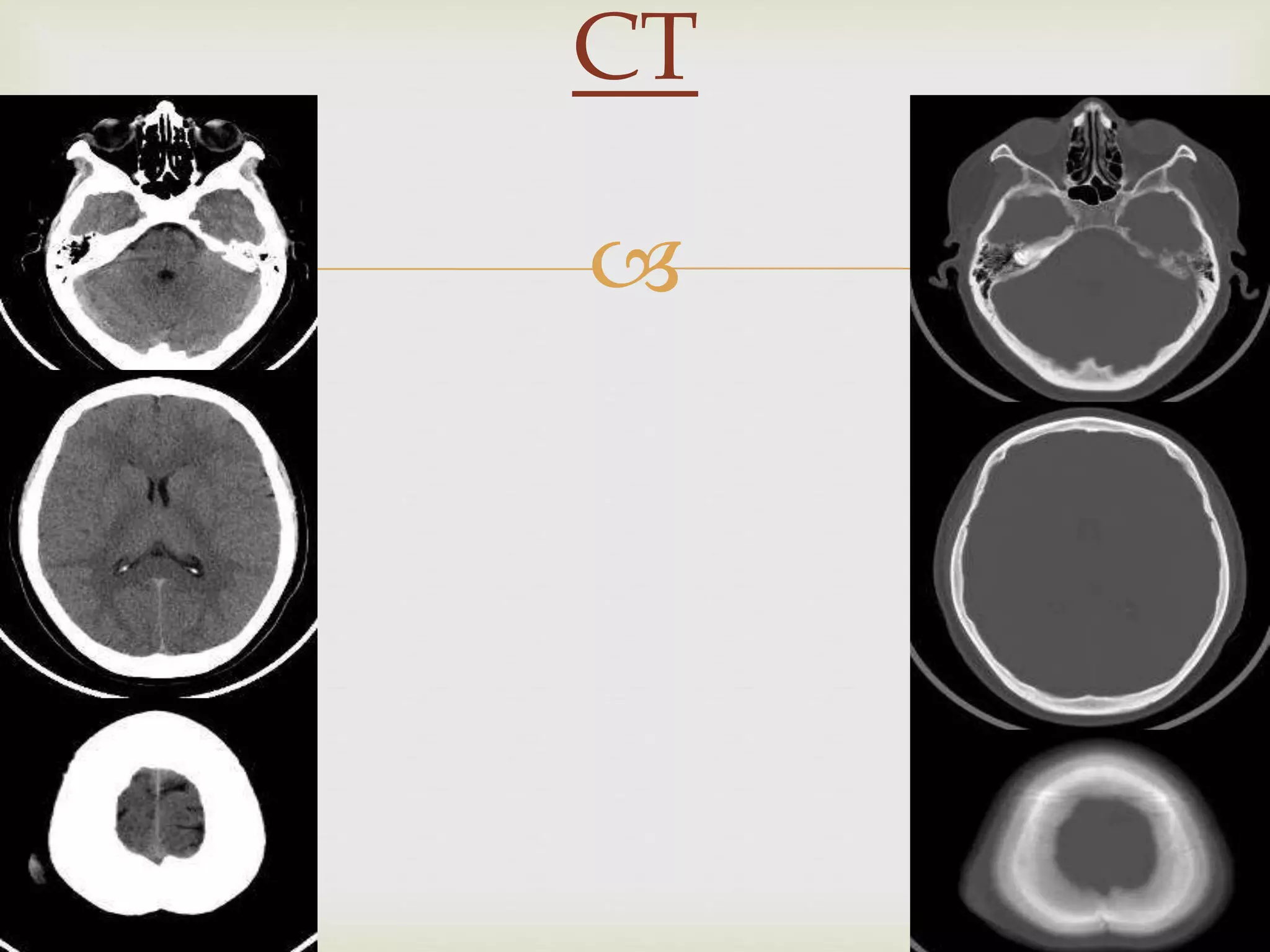 Neuro radiology neuroimaging | PPTX