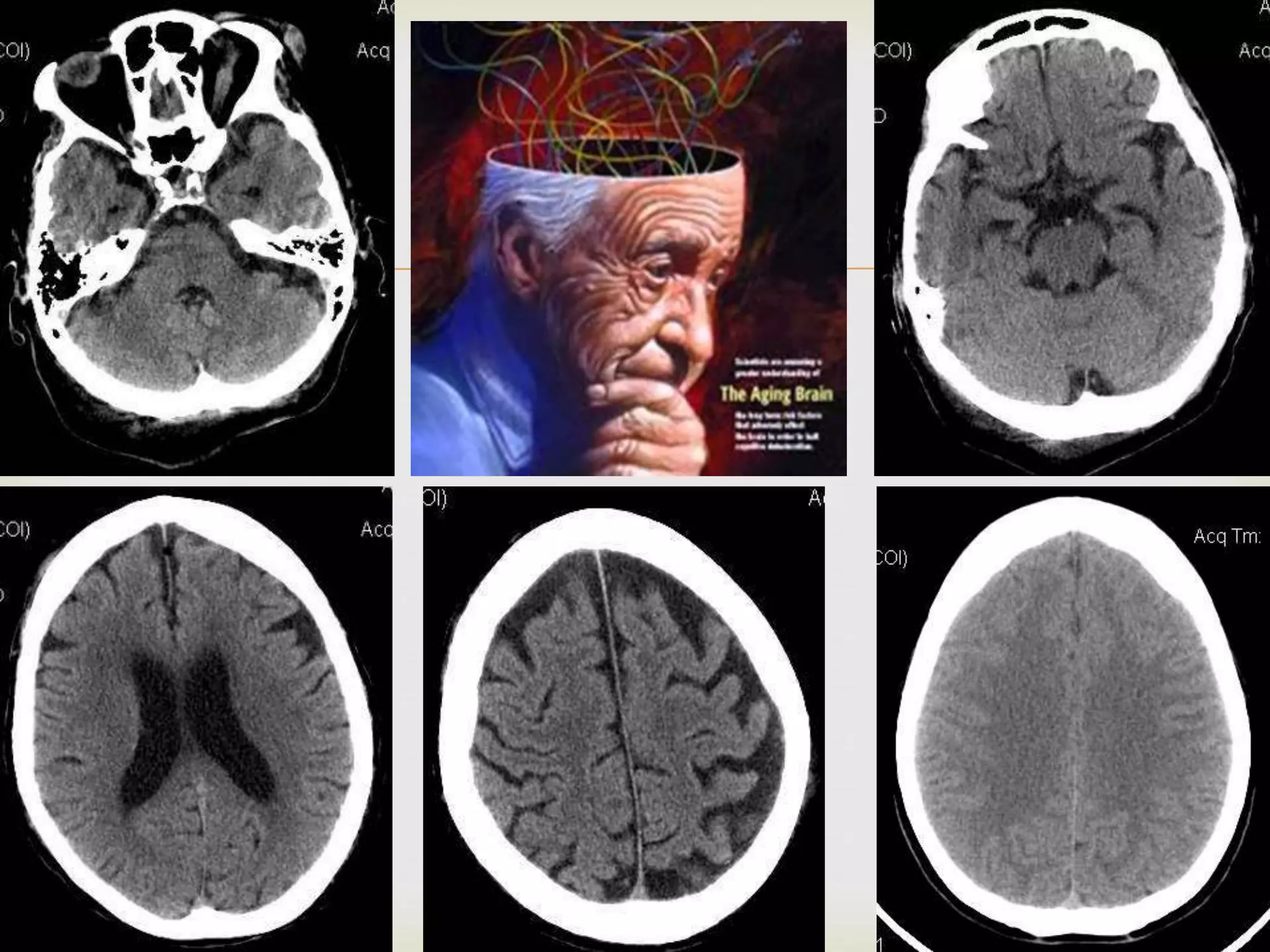 Neuro radiology neuroimaging | PPTX