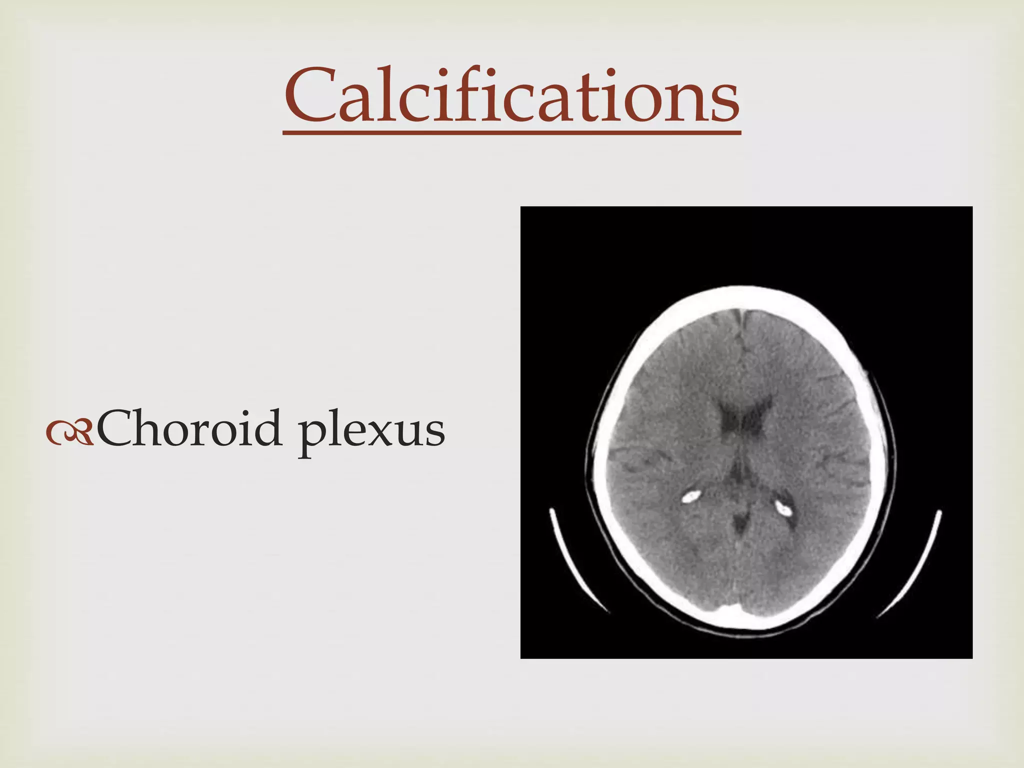 Neuro radiology neuroimaging | PPTX
