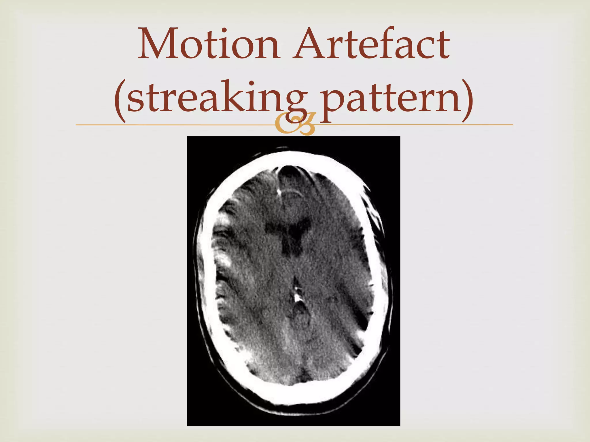 Neuro radiology neuroimaging | PPTX