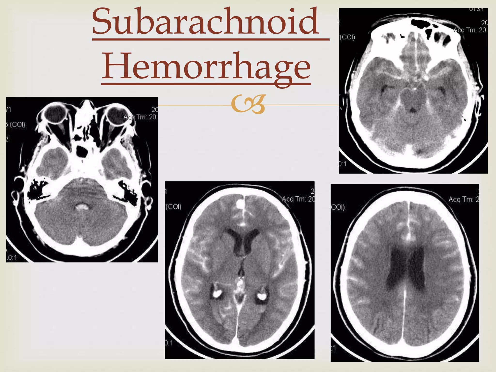 Neuro radiology neuroimaging | PPTX
