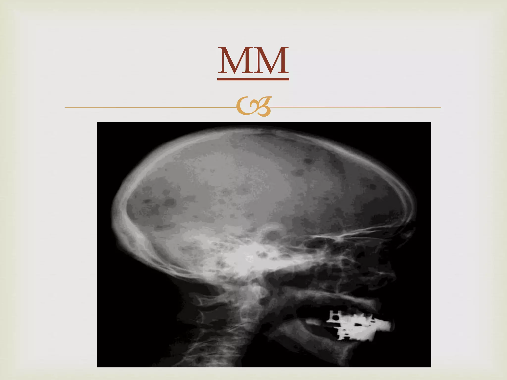 Neuro radiology neuroimaging | PPTX