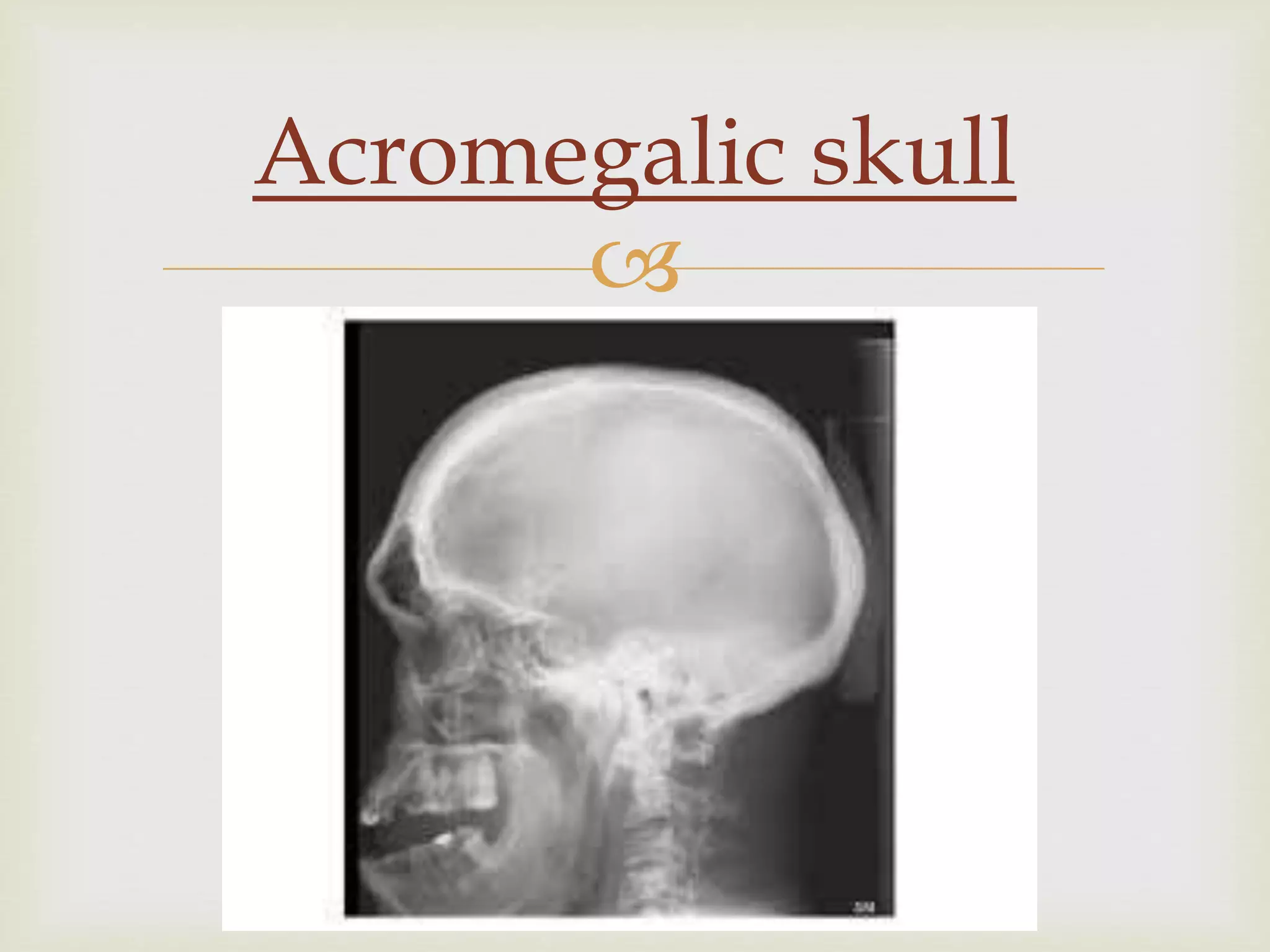 Neuro radiology neuroimaging | PPTX