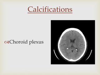 Neuro radiology neuroimaging | PPTX