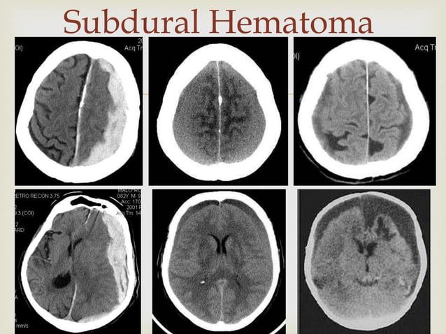 Neuro radiology neuroimaging | PPTX