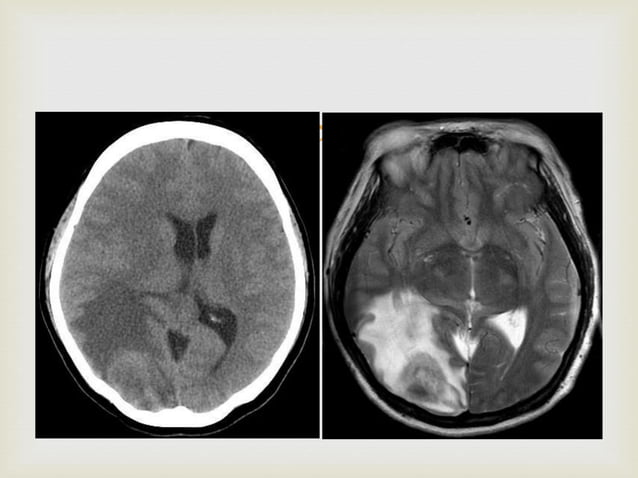 Neuro radiology neuroimaging | PPTX