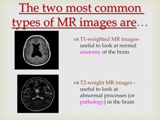 Neuro radiology neuroimaging | PPTX