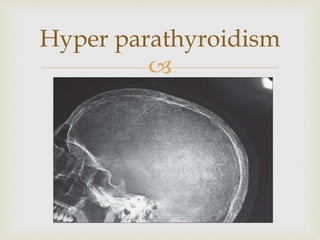 Neuro radiology neuroimaging | PPTX