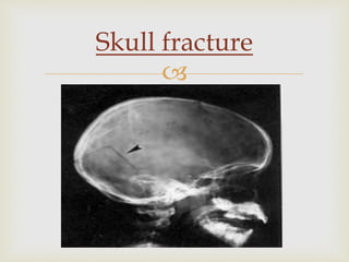 Neuro radiology neuroimaging | PPTX