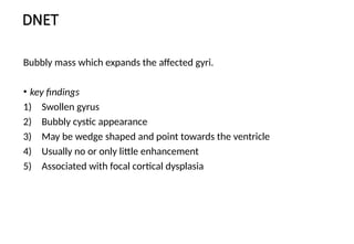 NEURORADIOLOGY EPILEPSY.pptx ppt on neuroradiology epilespsy | PPTX