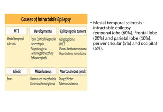 NEURORADIOLOGY EPILEPSY.pptx ppt on neuroradiology epilespsy | PPT
