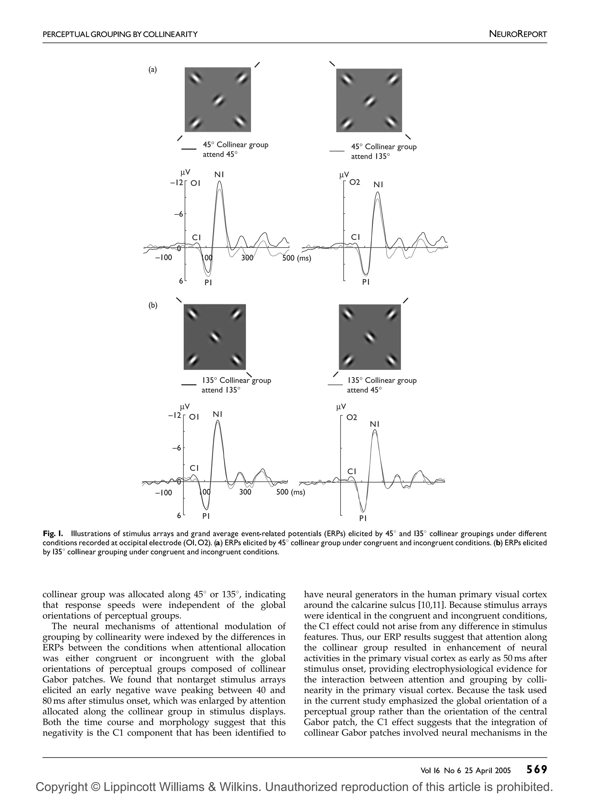 NeuroReport_Neural mechanisms of attentional modulation of perceptual grouping by collinearity | PDF