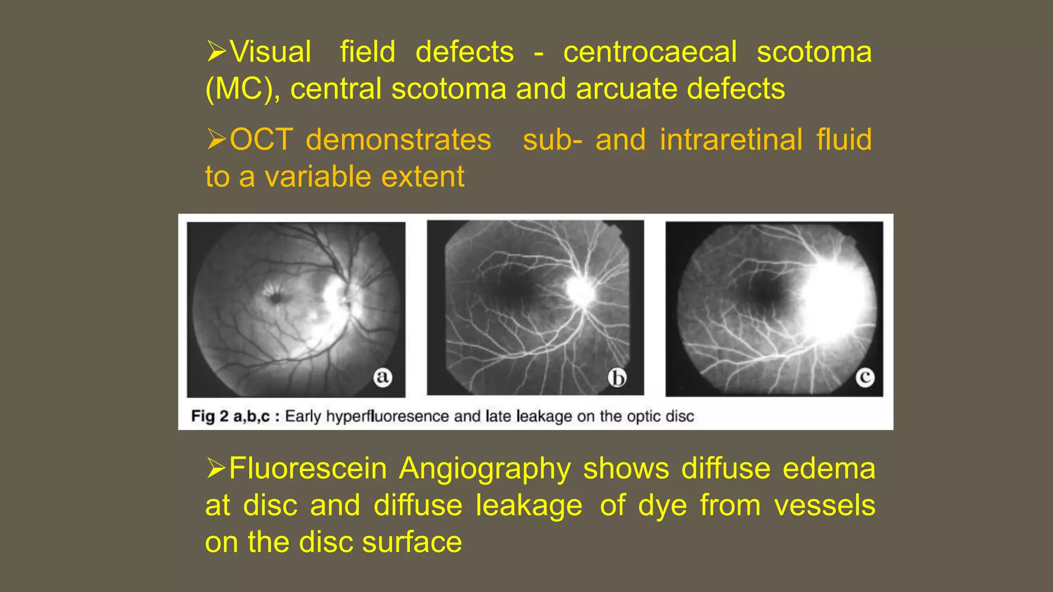 Neuroretinitis.pptx