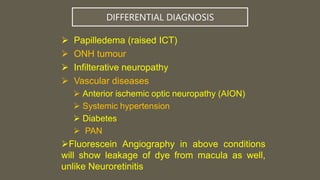 Neuroretinitis.pptx
