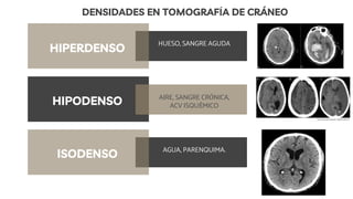 Neurorradiología Basica y Electro encefalograma digital | PPTX